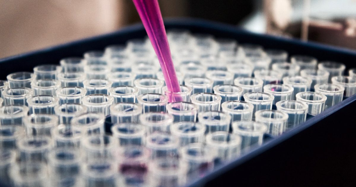 DNA Testing Prices | Paternity DNA test from £99 | Crystal Health