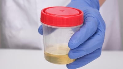 What are the benefits of point of care drug… | Drug Testing Clinics