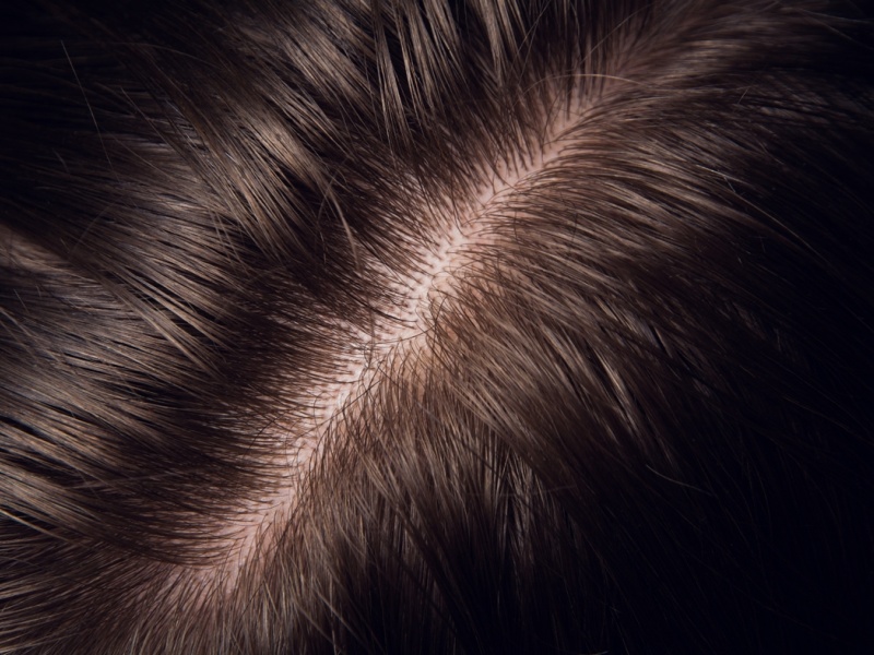 Benefits of hair segmentation for hair drug testing | Crystal Health