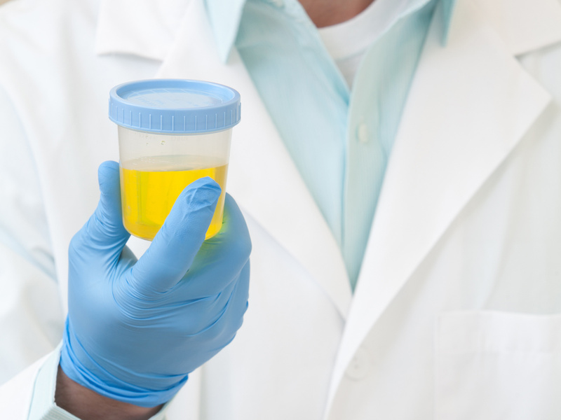 RISQS Accredited | Rail Drug Testing & PTS… | Drug Testing Clinics